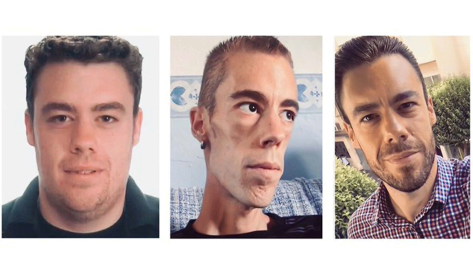 El peligro de los trastornos alimenticios | Canal Extremadura